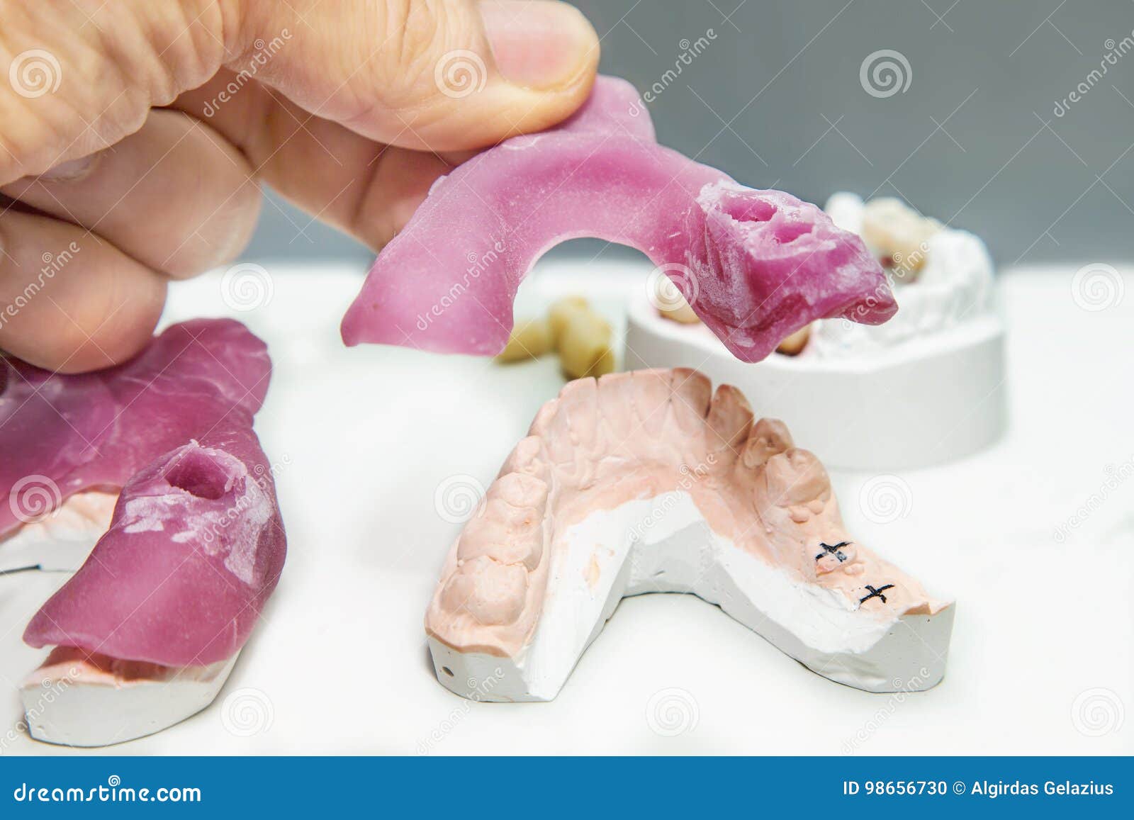 Technical Shots of Model on a Dental Prothetic Laboratory Stock Photo ...