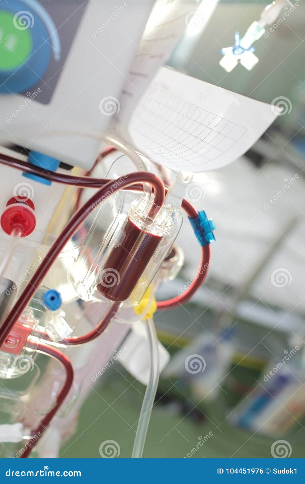 Technical Unit with Tubes Filled with Blood in the Hospital Ward Stock ...