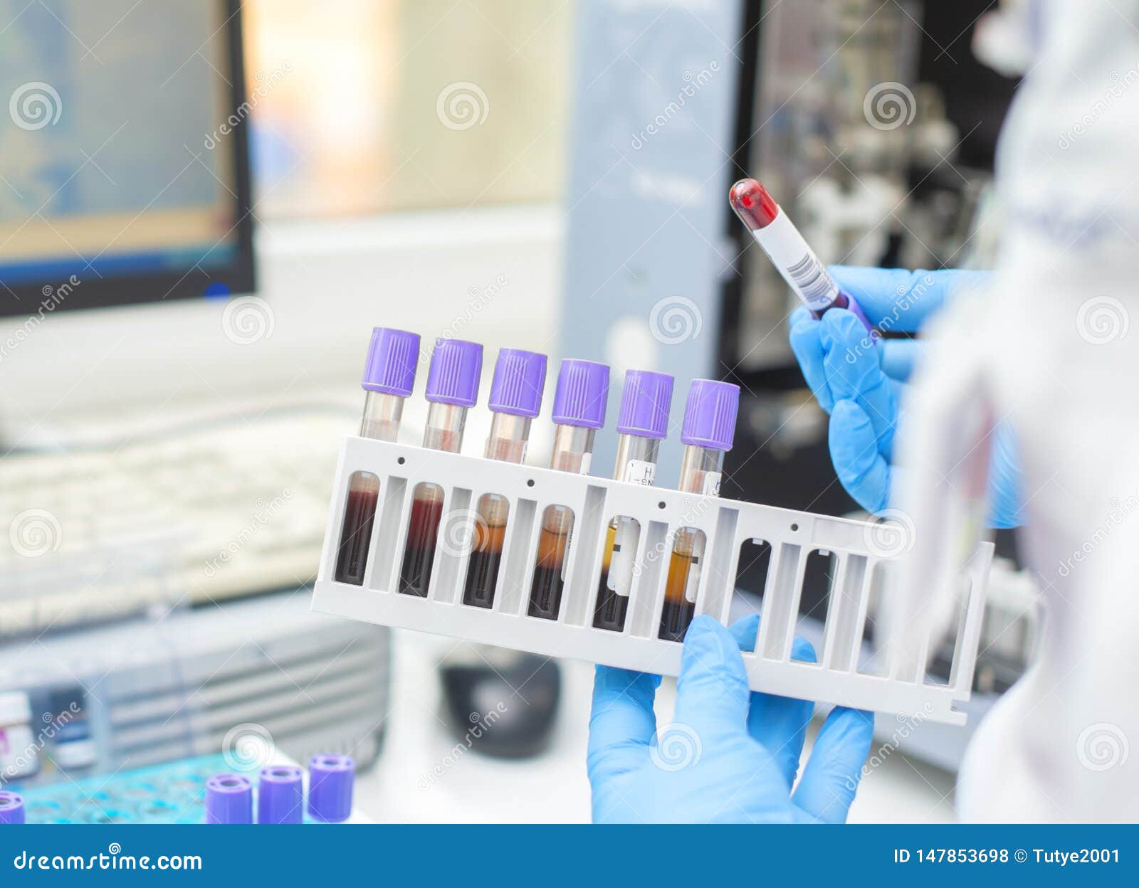 Blood Tube Test With Requisition Form For CMP Comprehensive Metabolic ...