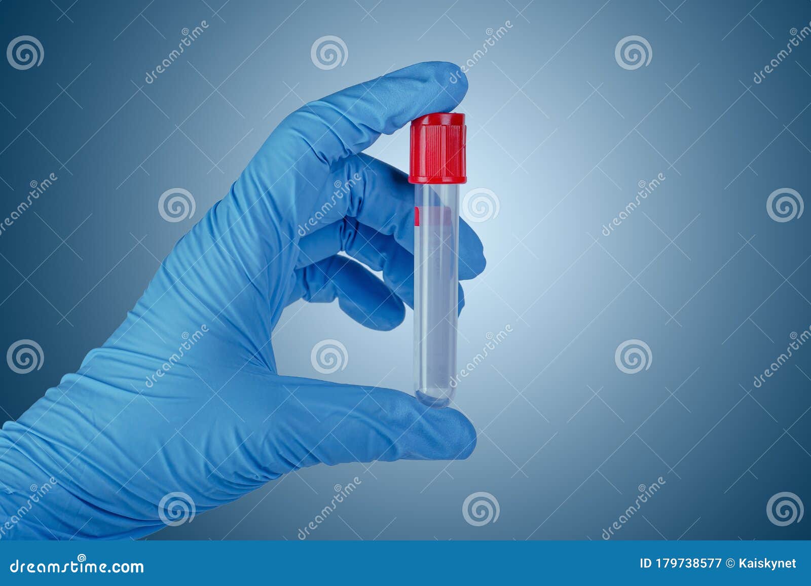 Blood Tube Test With Requisition Form For BMP Basic Metabolic Panel ...