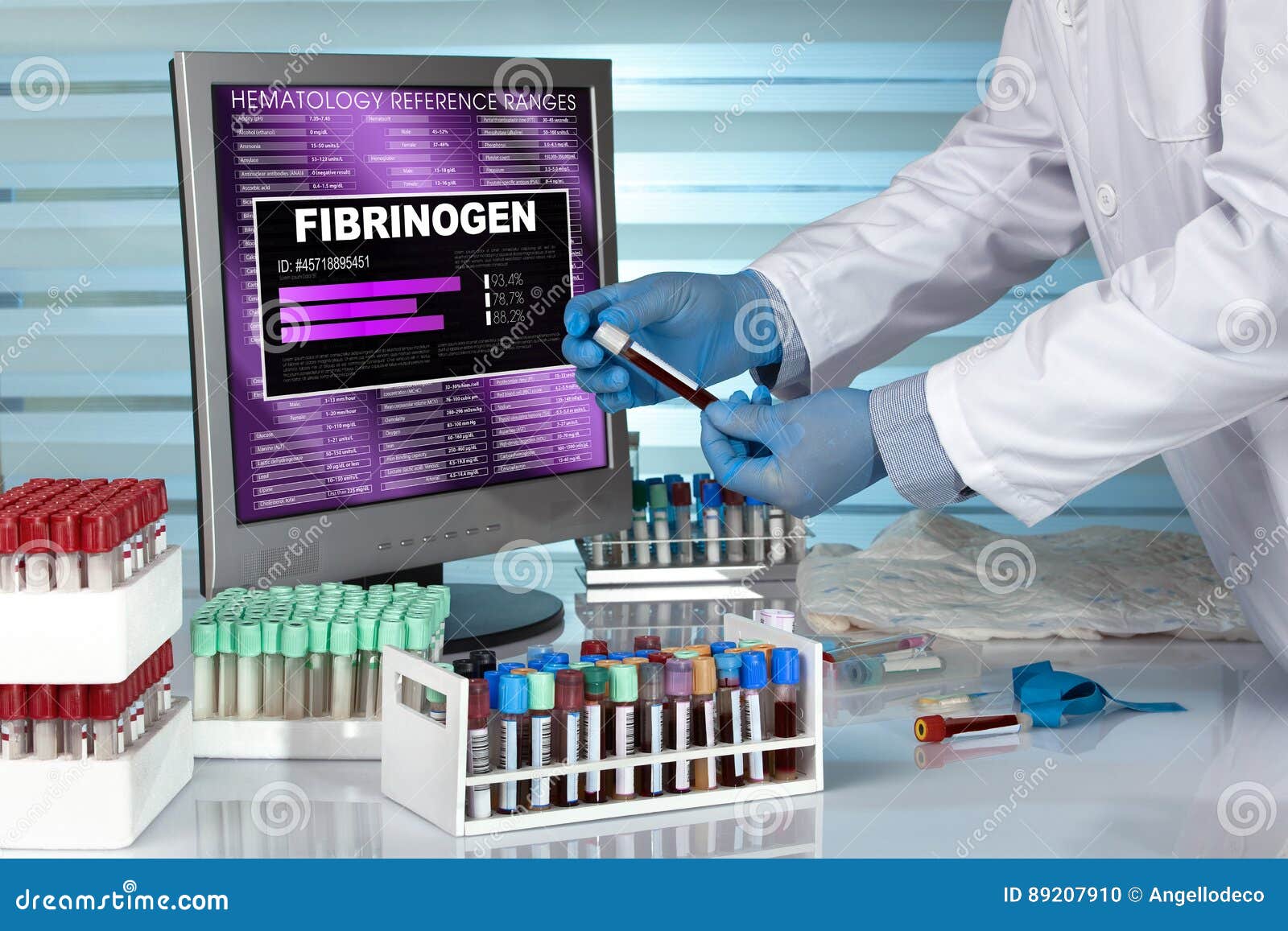Technician in Lab Examining Blood Sample with Results in Compute Stock ...