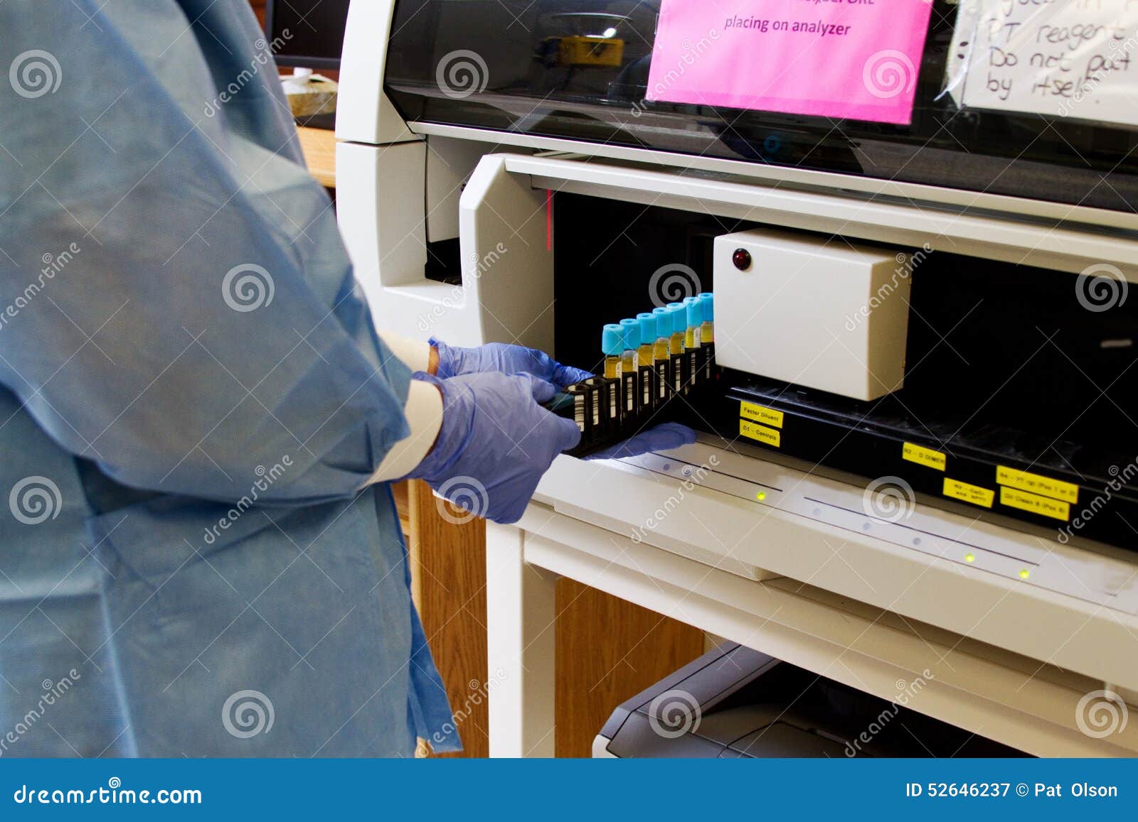 Technician Loading Specimens for Coagulation Test Stock Image - Image ...