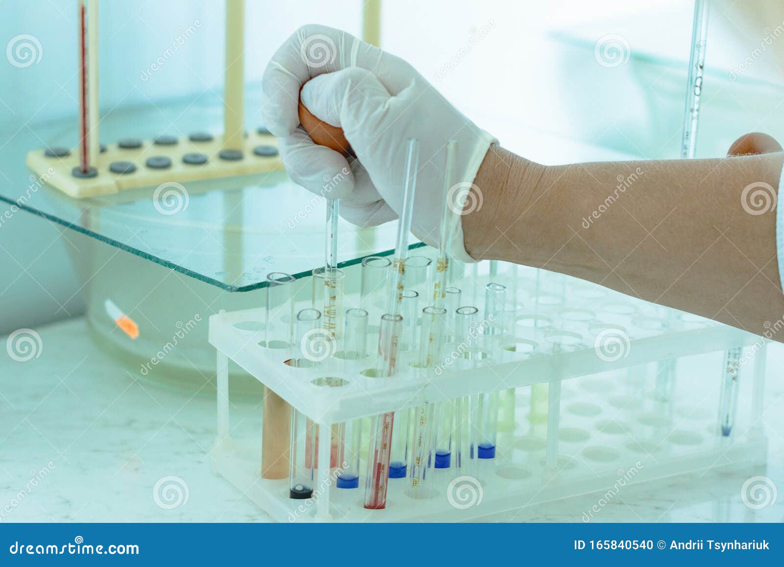 The Technician Performs a General Blood Test for the Patient Stock ...