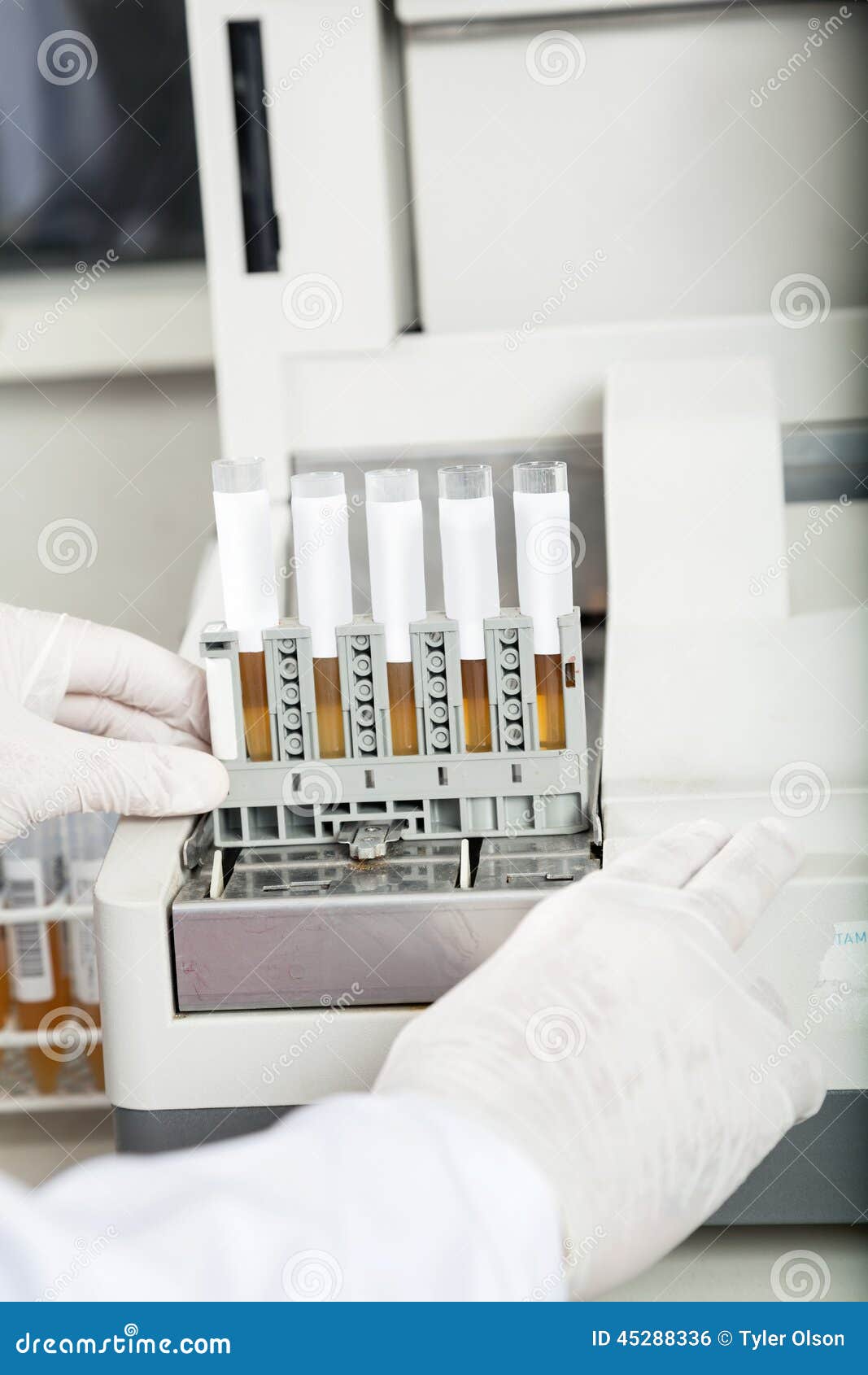 Technician Using Urine Analyzer To Test Samples Stock Photo - Image of ...