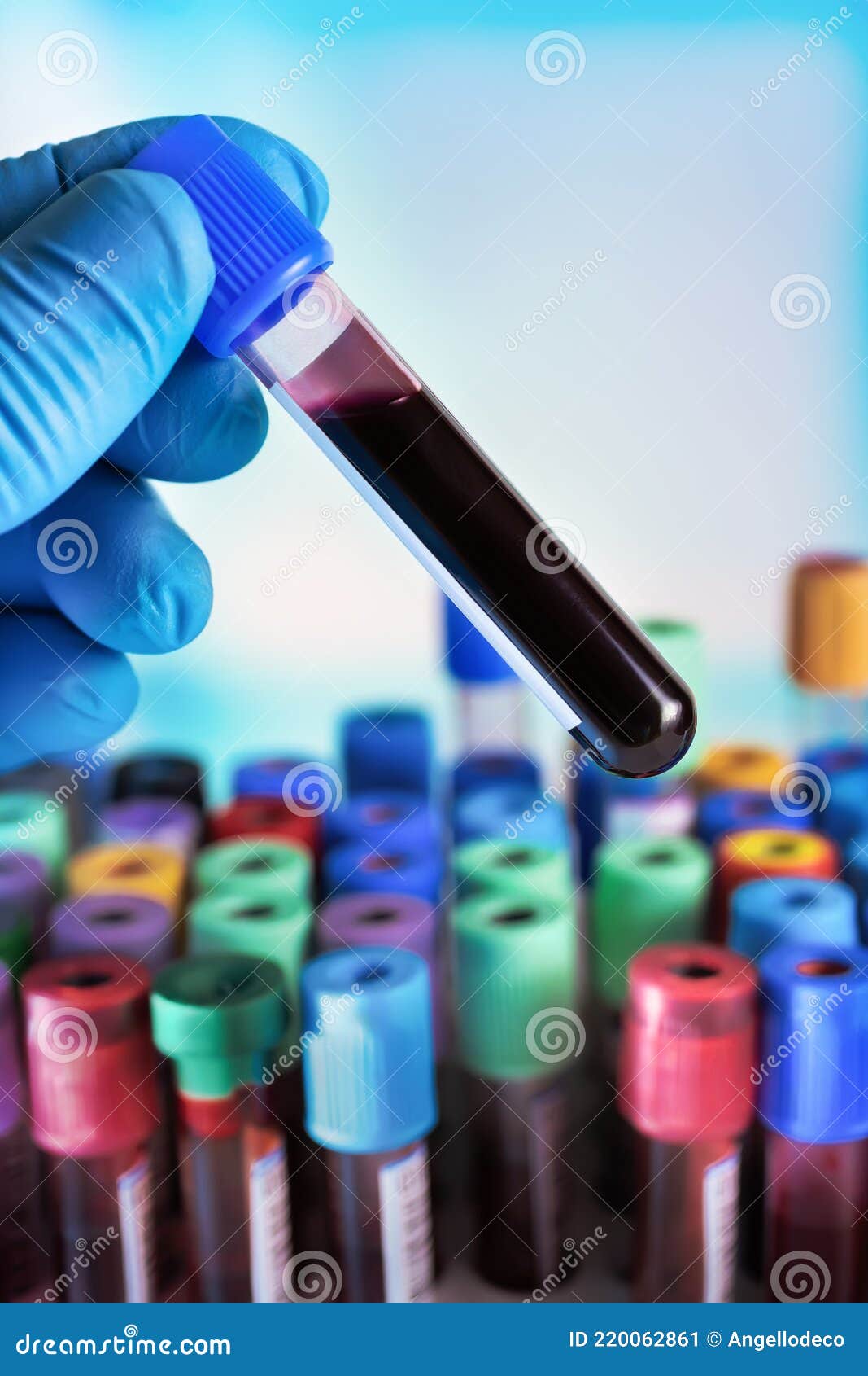 Technician Working with Blood Tube Sample for Testing in the ...
