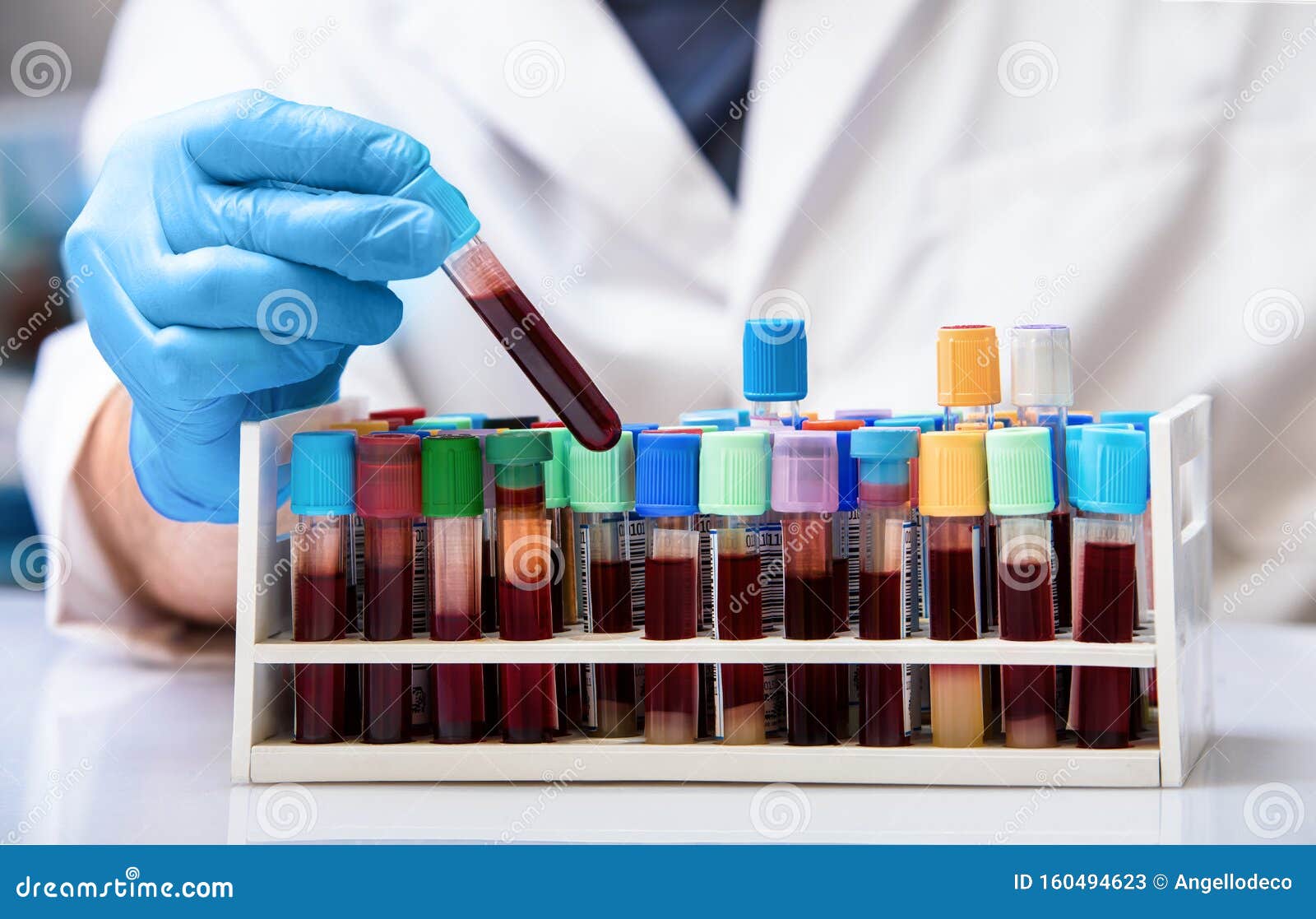 Technician Working Whit Blood Samples Tubes in the Blood Bank Stock ...