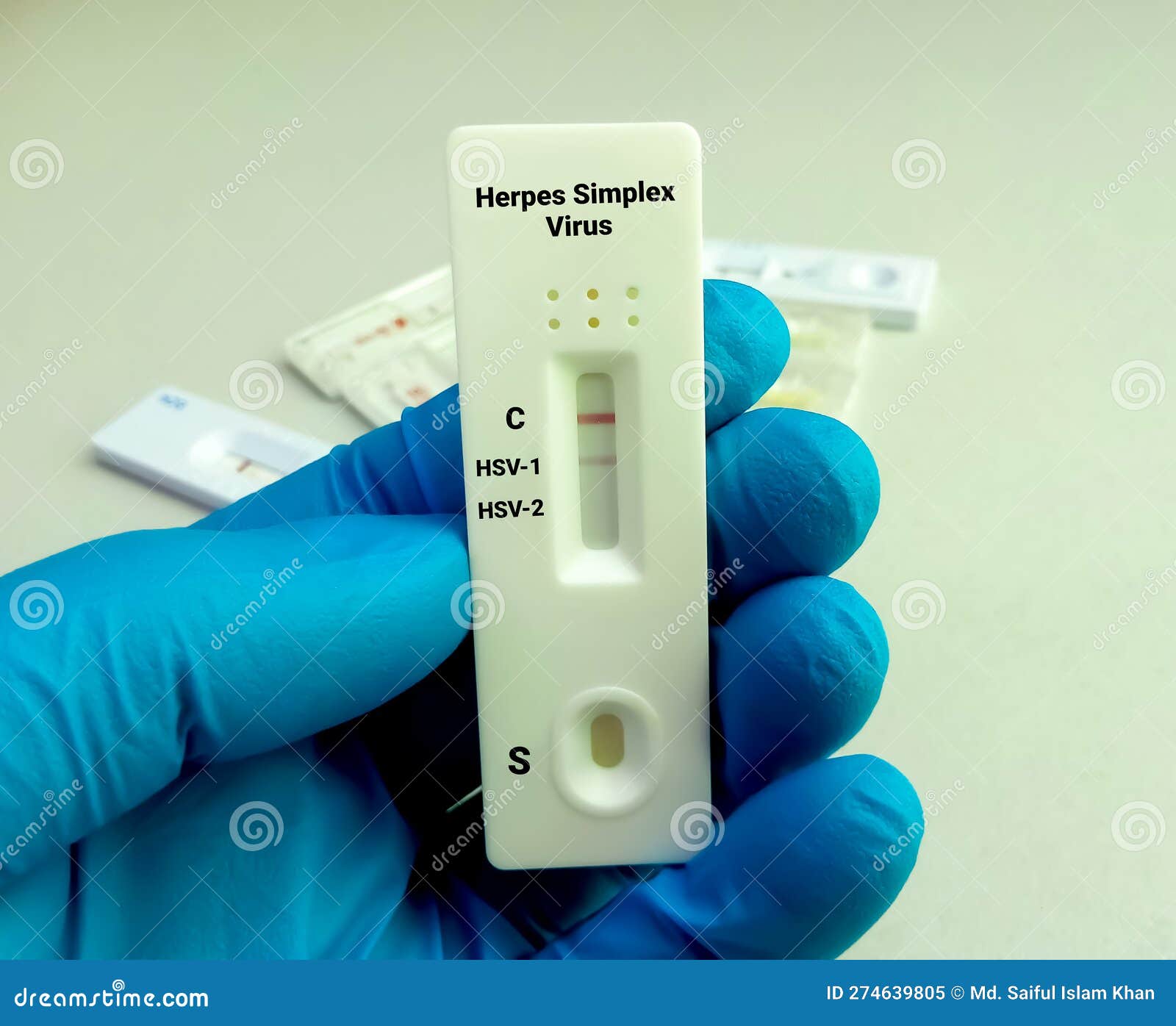 Technologist Hand Hold a Device of Herpes Simplex Virus Rapid Screening ...