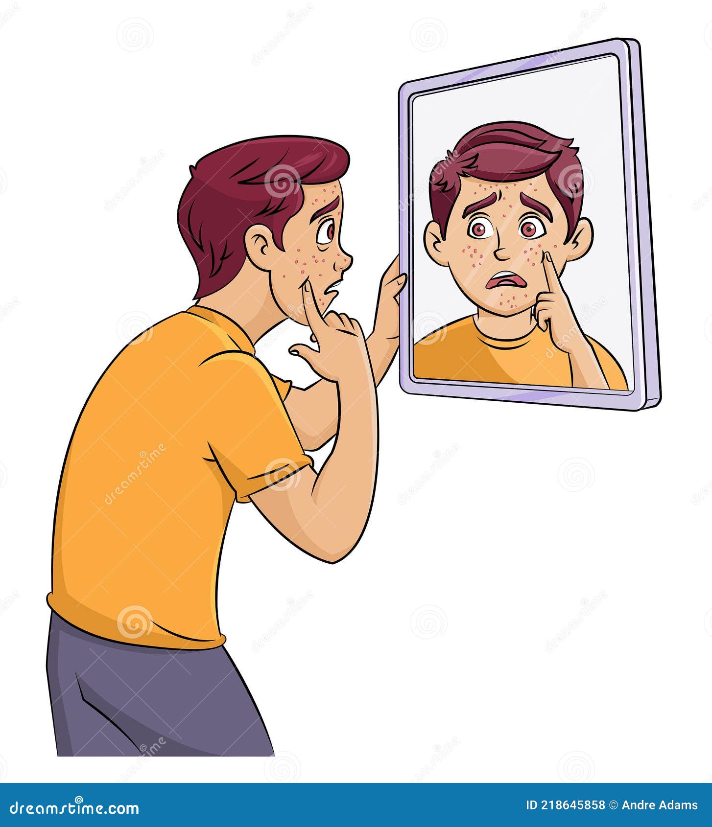 Teenage boy with pimples stock vector. Illustration of acne - 218645858