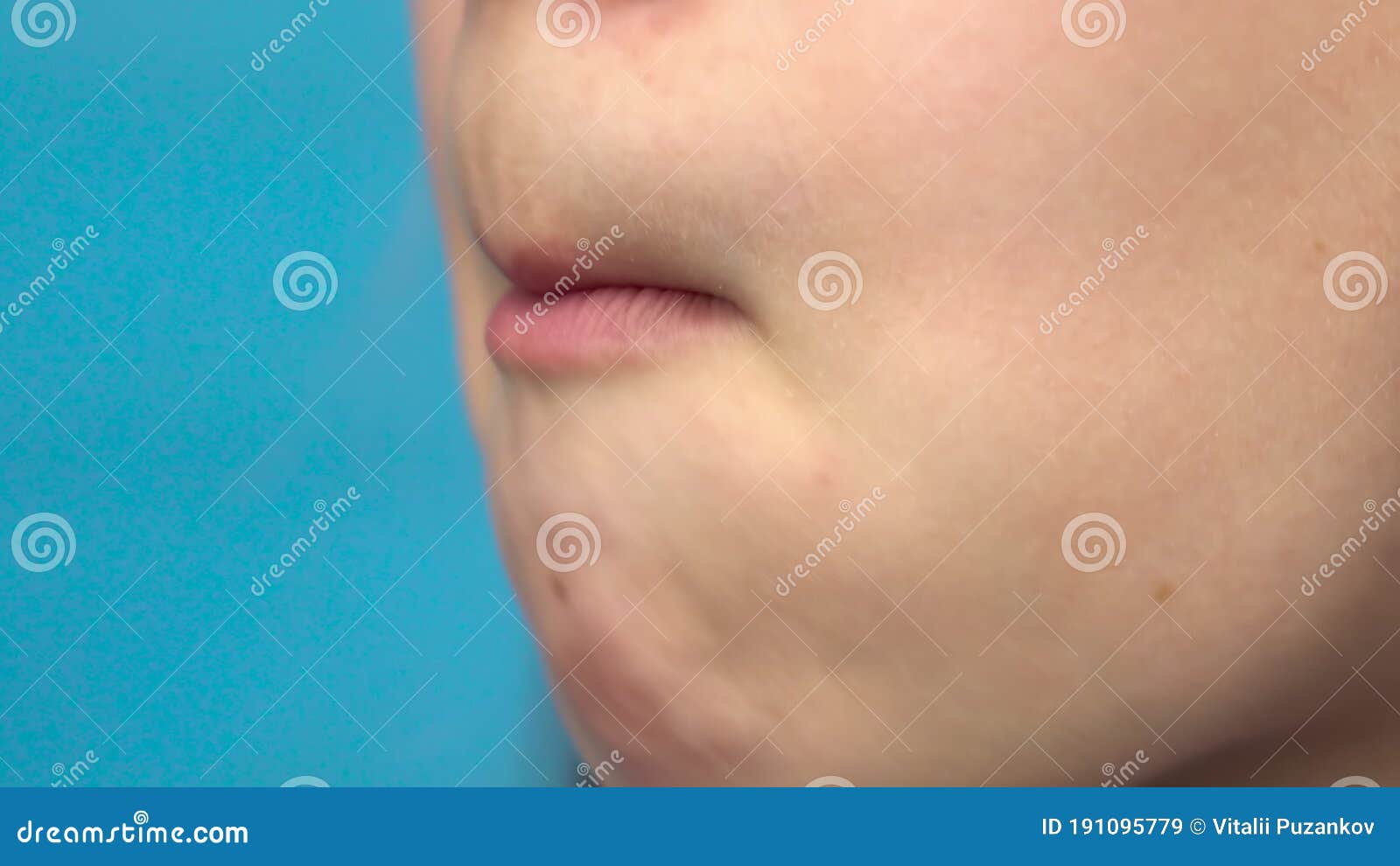 Teenage Girl With Braces On Her Teeth Eats Celery On A Blue Background