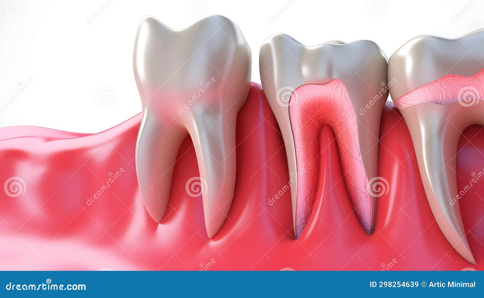 Teeth in 3D Detailed Rendering Showcase Imagen de archivo - Imagen de ...