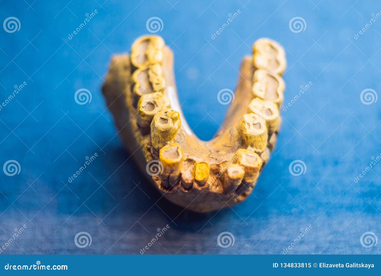 Teeth Of An Ancient Man. Human Evolution Is The Evolutionary Process ...