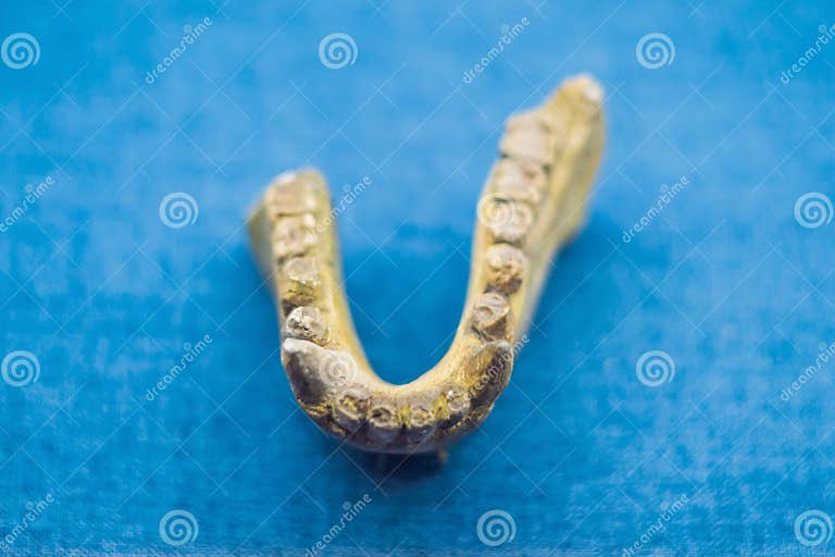 Teeth of an Ancient Man. Human Evolution is the Evolutionary Process ...