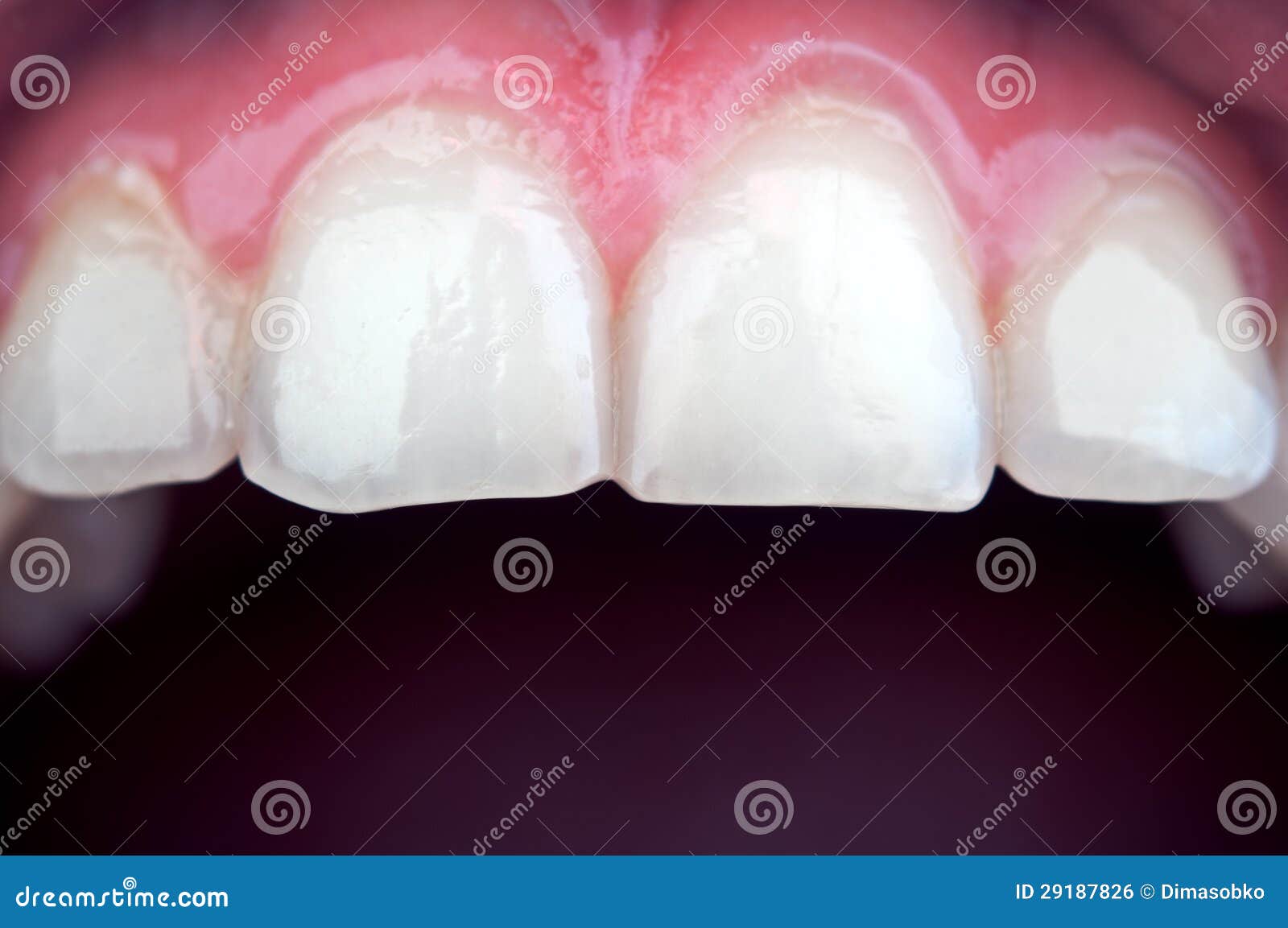 Teeth background stock photo. Image of dental, medical - 29187826