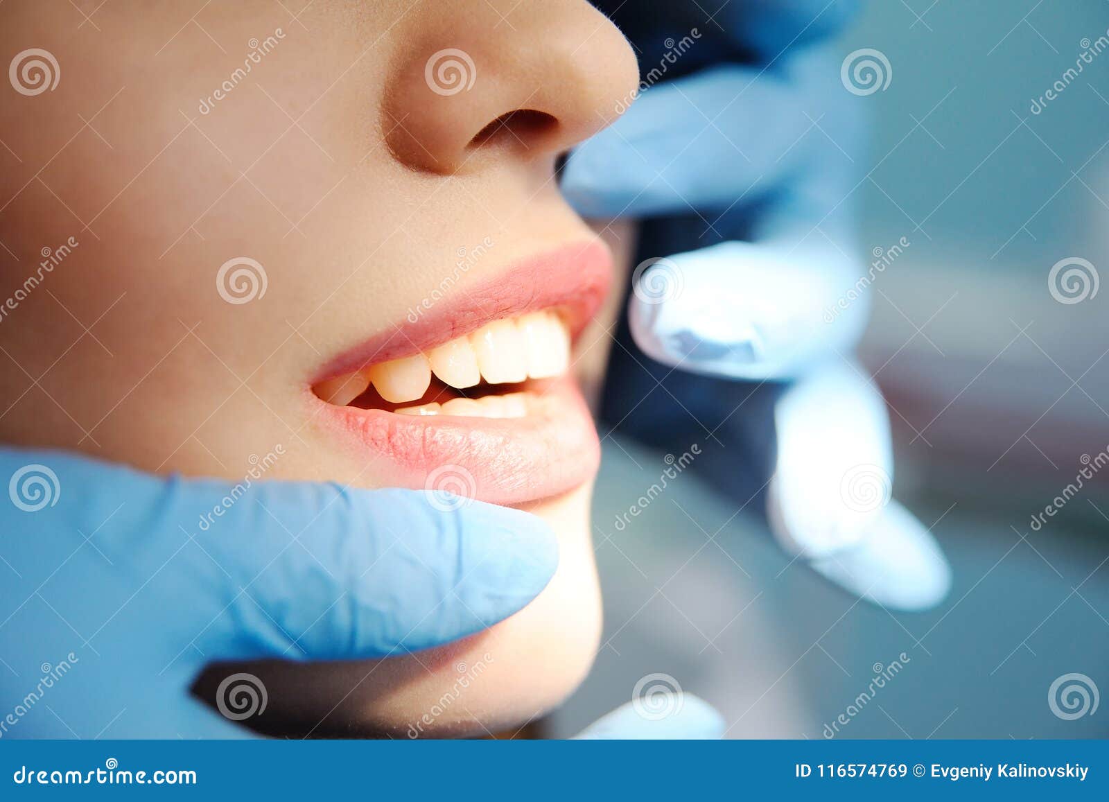 Teeth Of A Beautiful Girl Closeup Stock Image Image Of Prevention