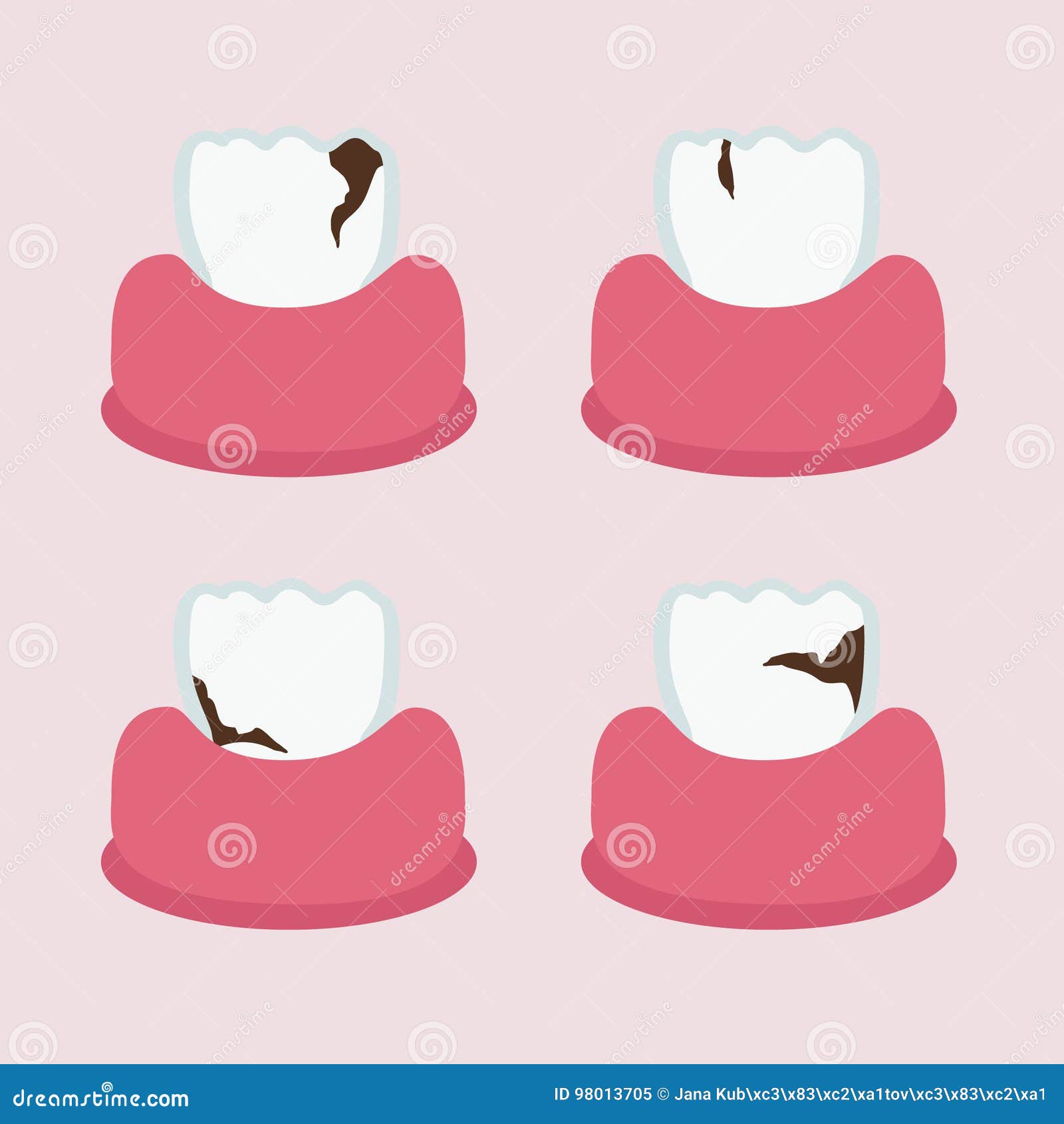 Teeth With Cavities Illustrations | CartoonDealer.com #99230016