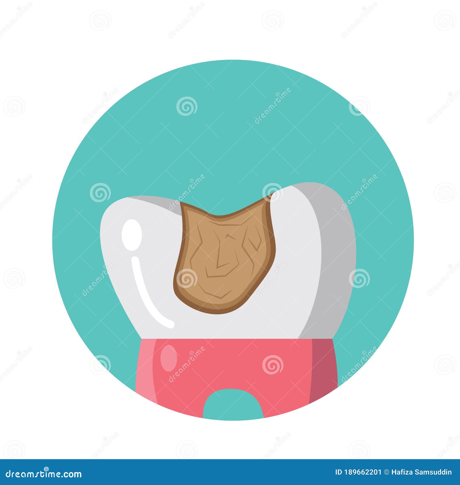Teeth with Cavity. Vector Illustration Decorative Design Stock Vector ...