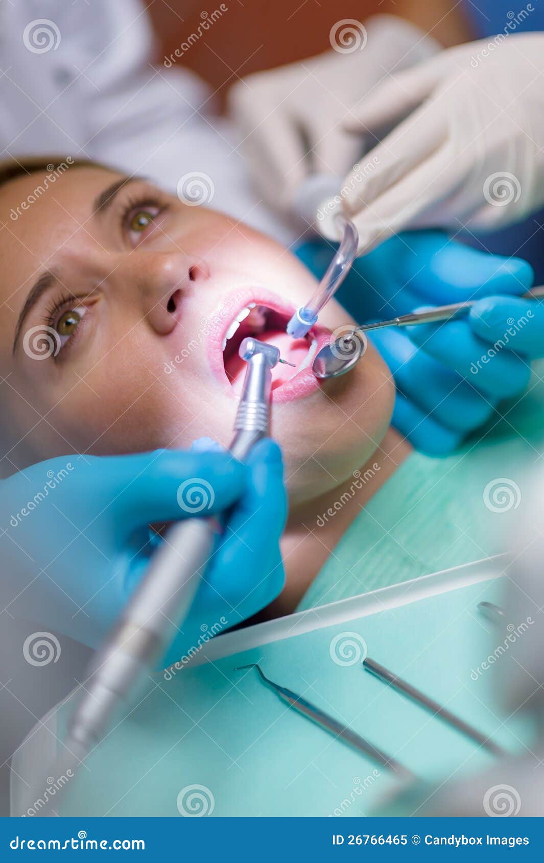 Teeth Check-up Open Mouth and Dental Tools Stock Image - Image of ...
