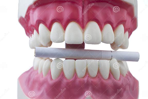 Teeth and a cigarette stock photo. Image of dentist, dental - 45127666