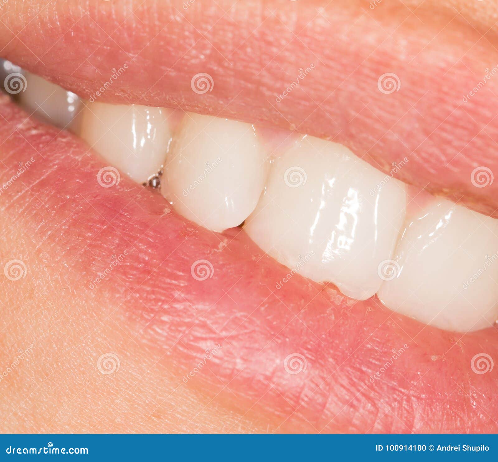 Teeth. close-up stock photo. Image of people, adult - 100914100