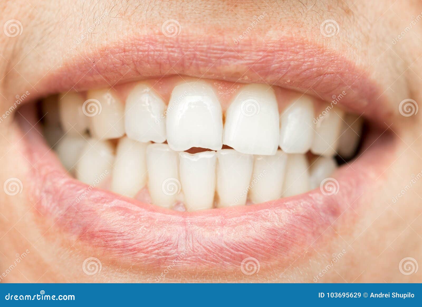 Teeth. close-up stock image. Image of beautiful, lipstick - 103695629