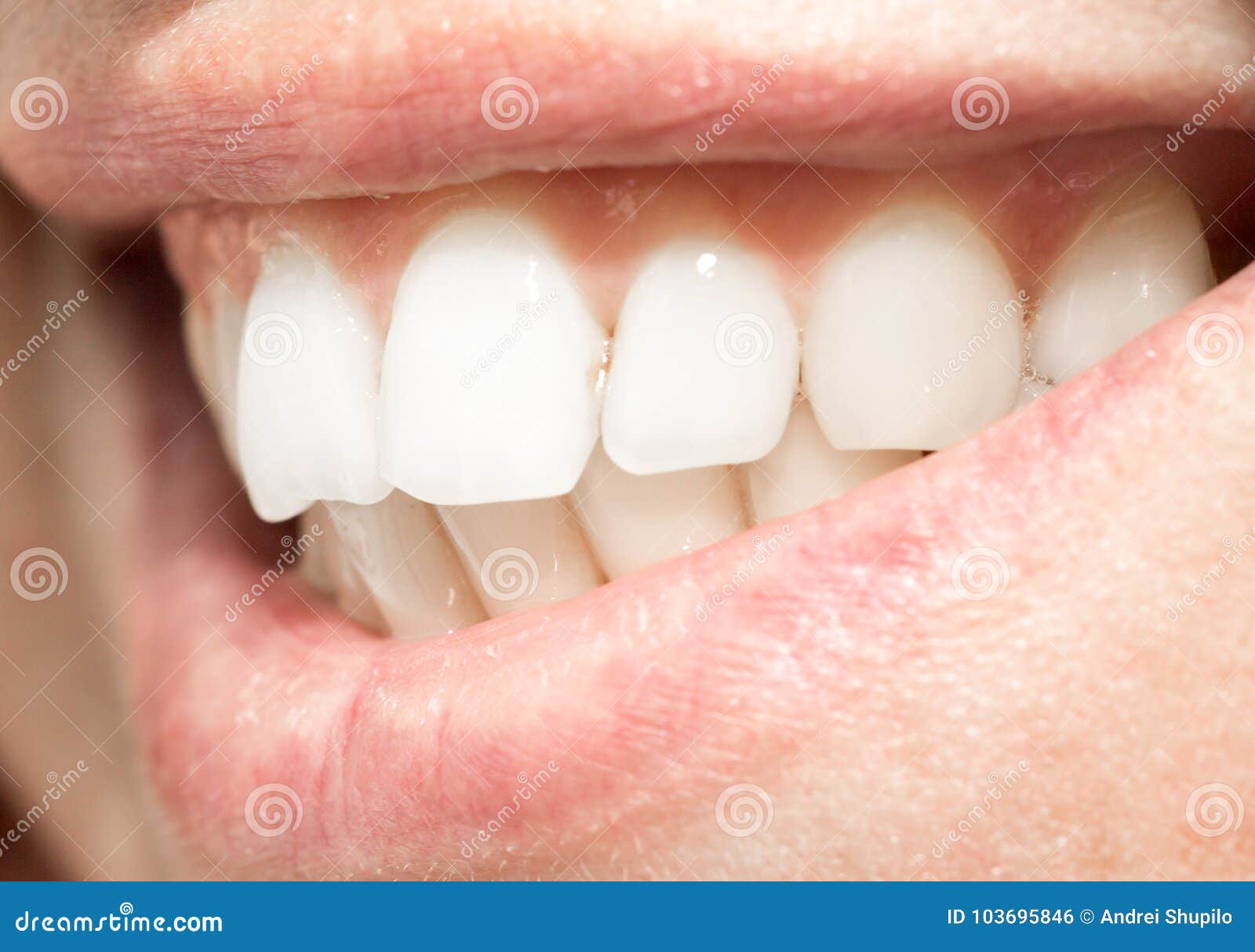Teeth. close-up stock photo. Image of beautiful, closeup - 103695846