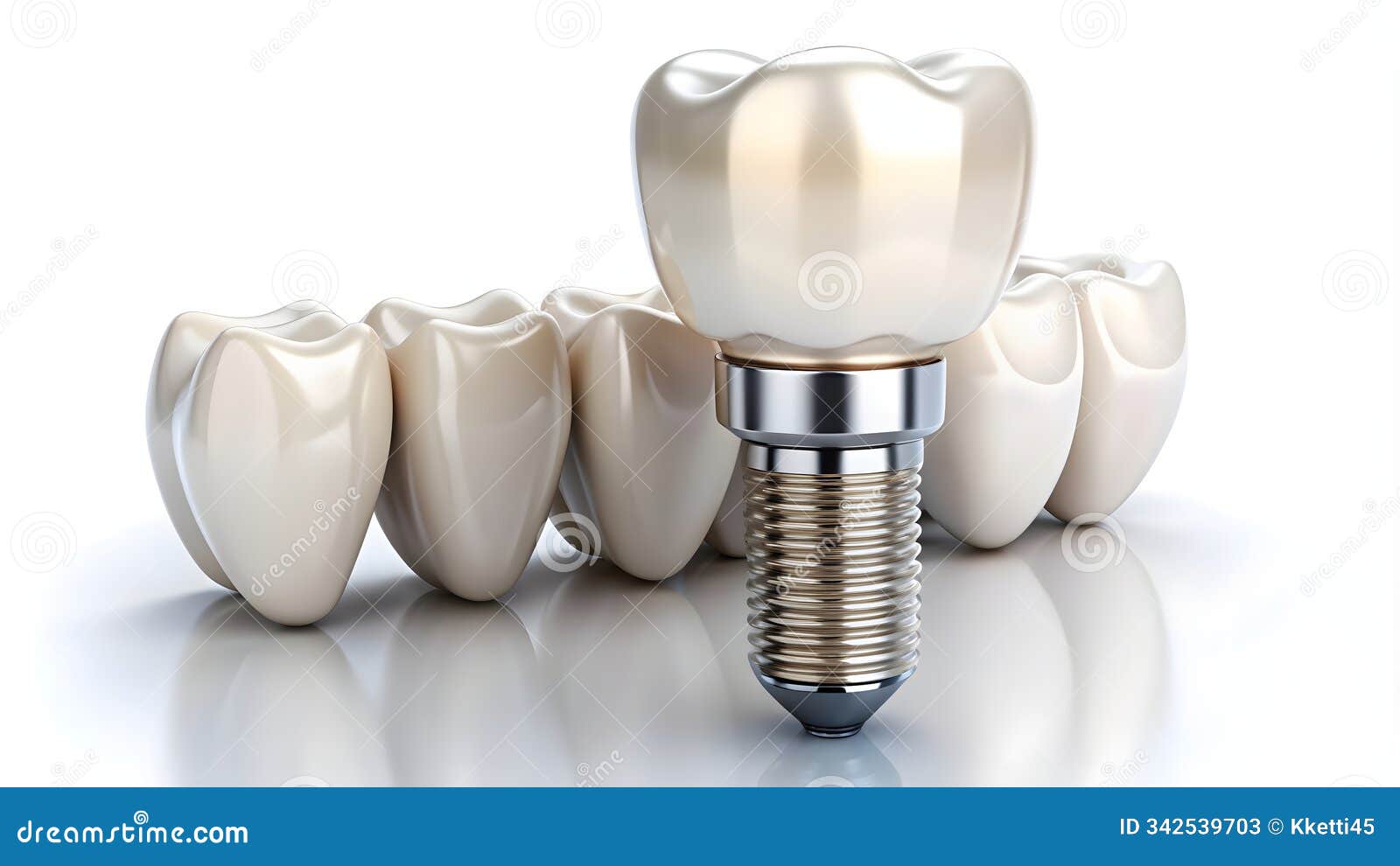Teeth with Dental Implant Over White Background with Reflection Stock ...