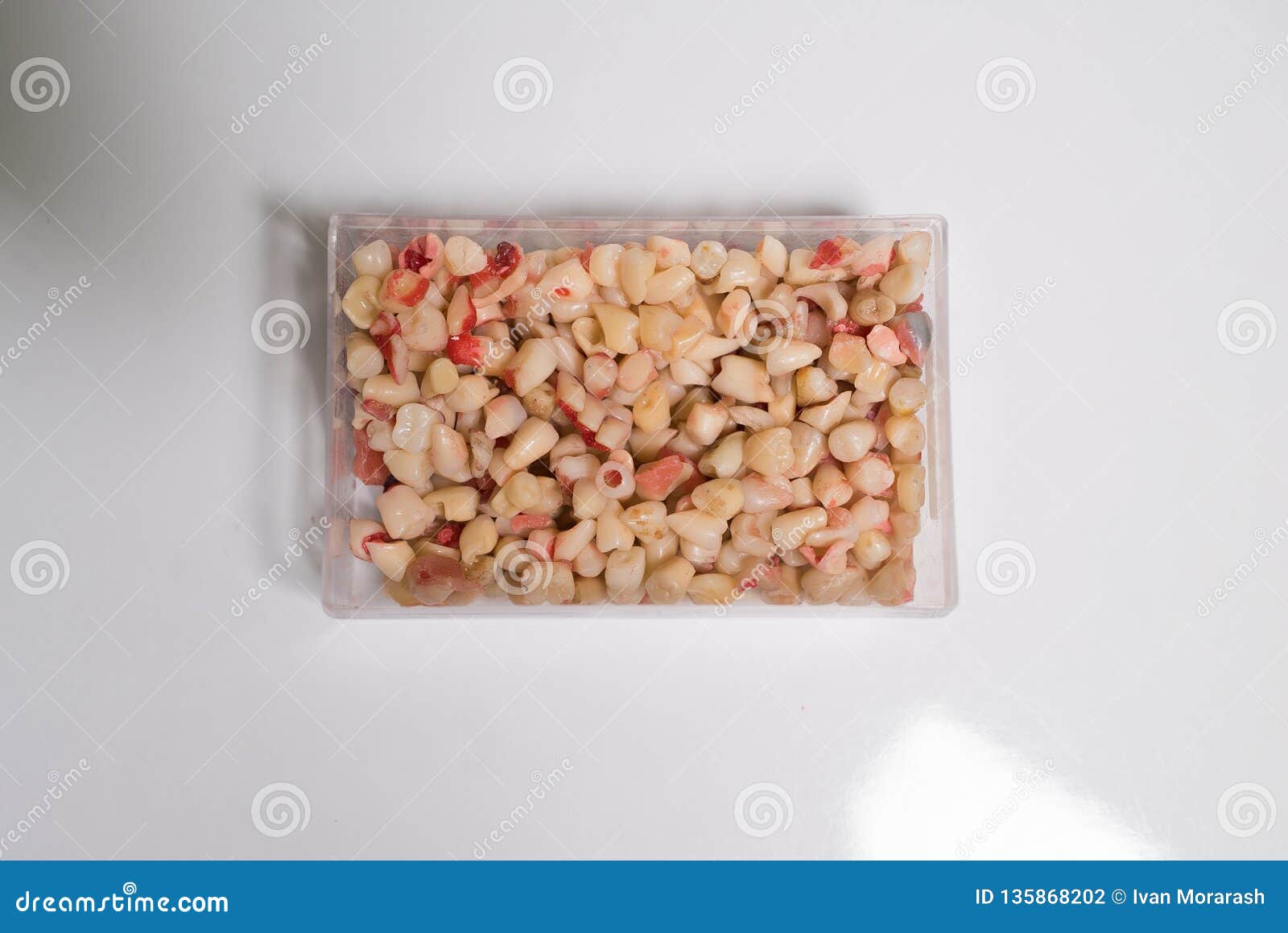 Teeth, Dentures, in Large Quantities in a Plastic Box Stock Photo ...