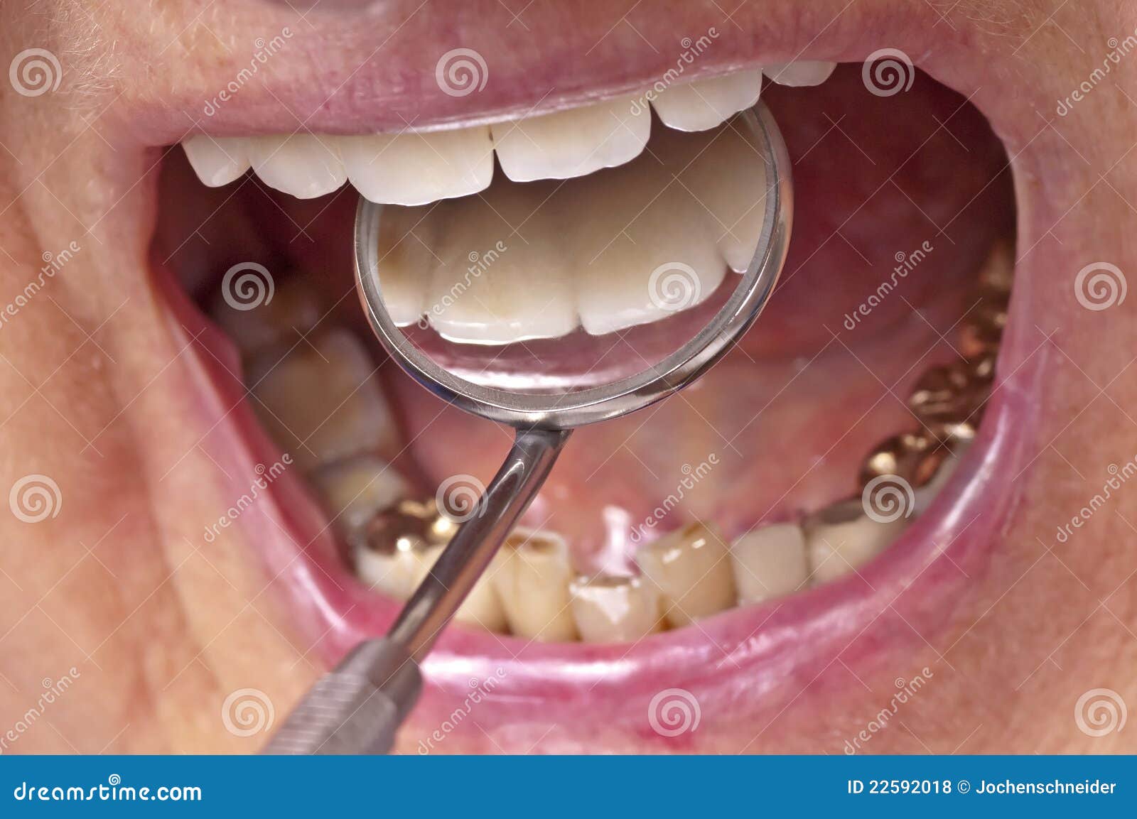 Teeth examination stock photo. Image of dentist, white - 22592018
