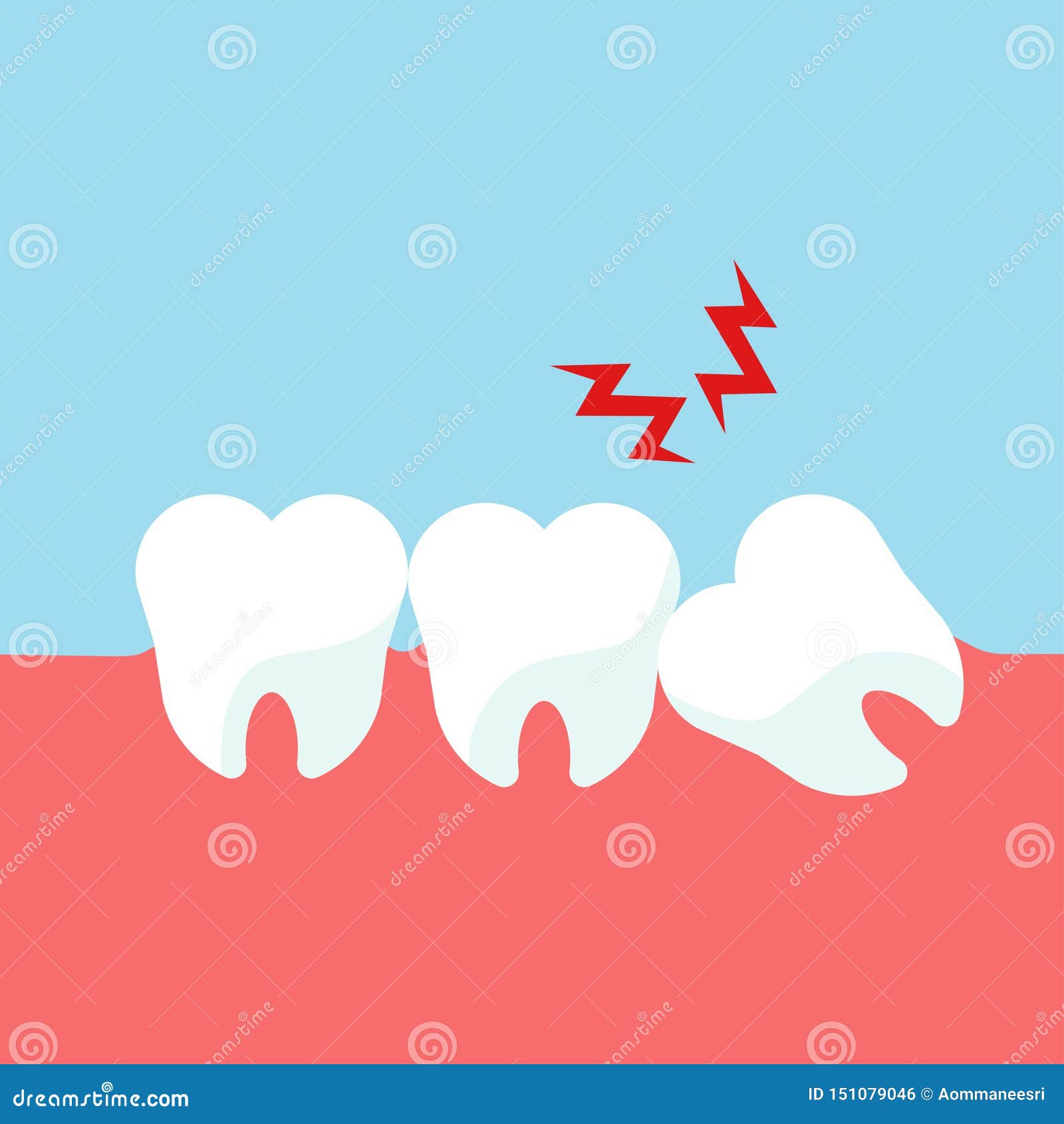 Impacted Wisdom Tooth For Dentistry And Dental Surgery Icon Vector ...