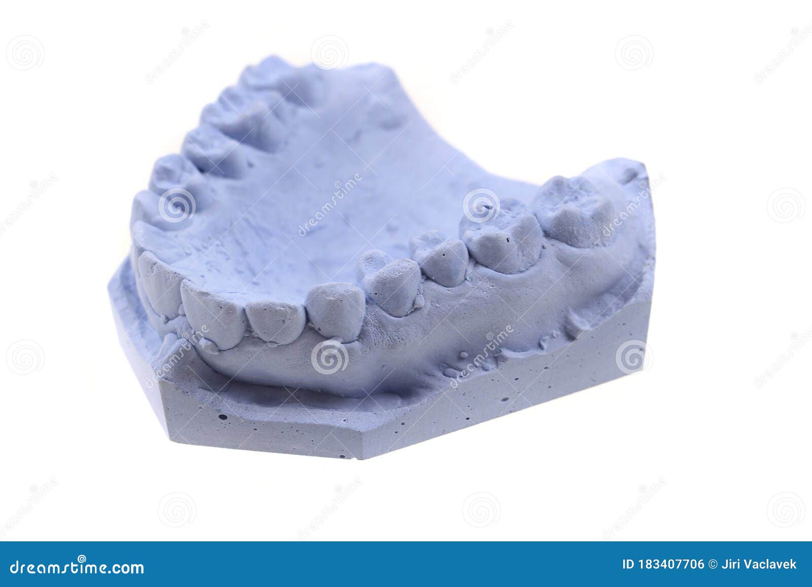 Teeth Gypsum Model Isolated Stock Photo - Image of white, denture ...
