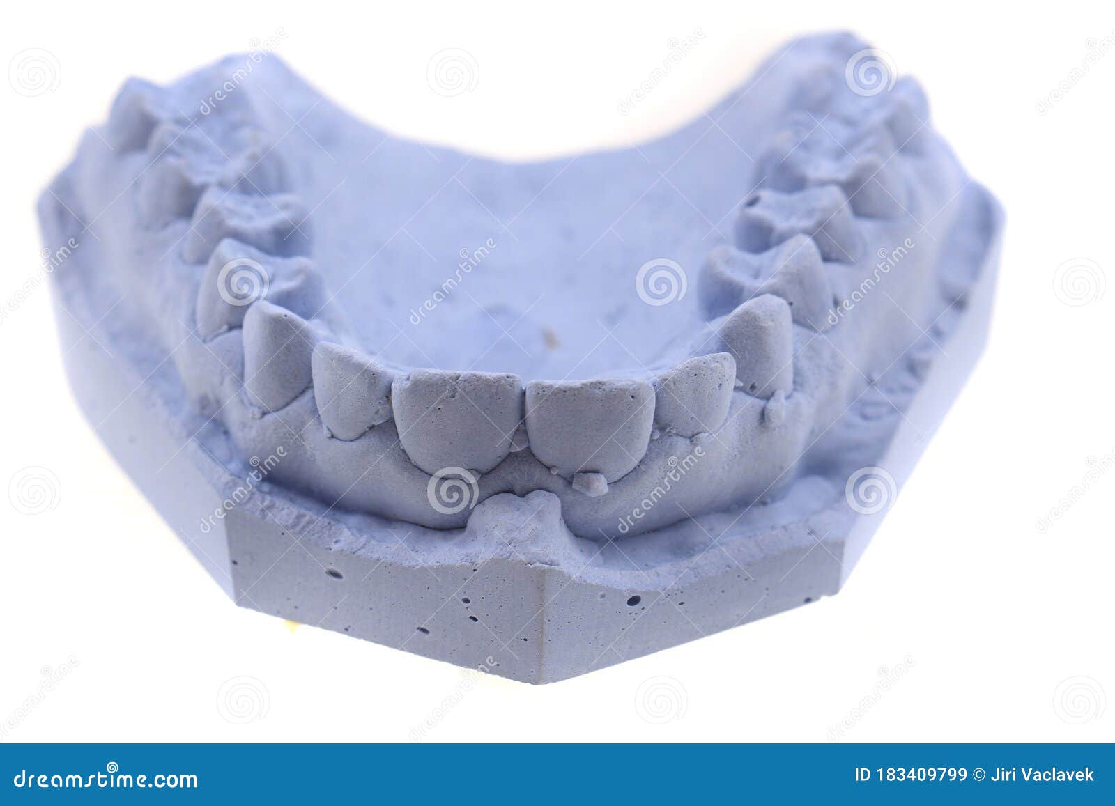 Teeth Gypsum Model Isolated Stock Image - Image of orthodontist ...