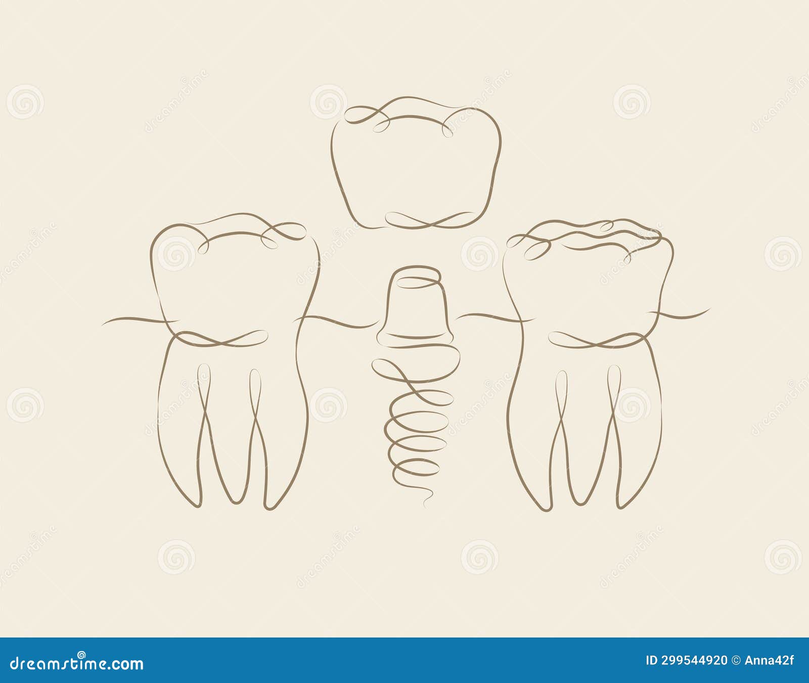 Teeth implant beige color stock vector. Illustration of denture - 299544920
