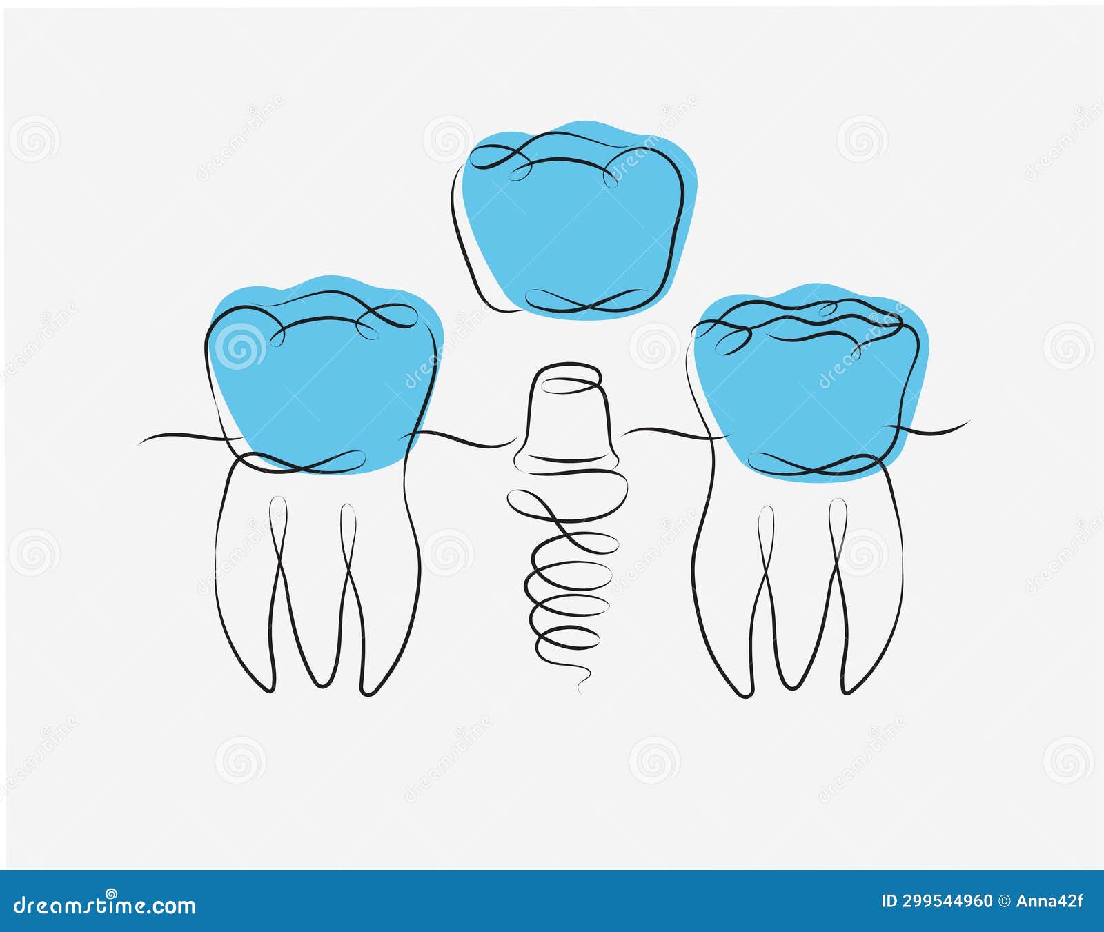 Teeth Implant White and Blue Stock Vector - Illustration of oral ...