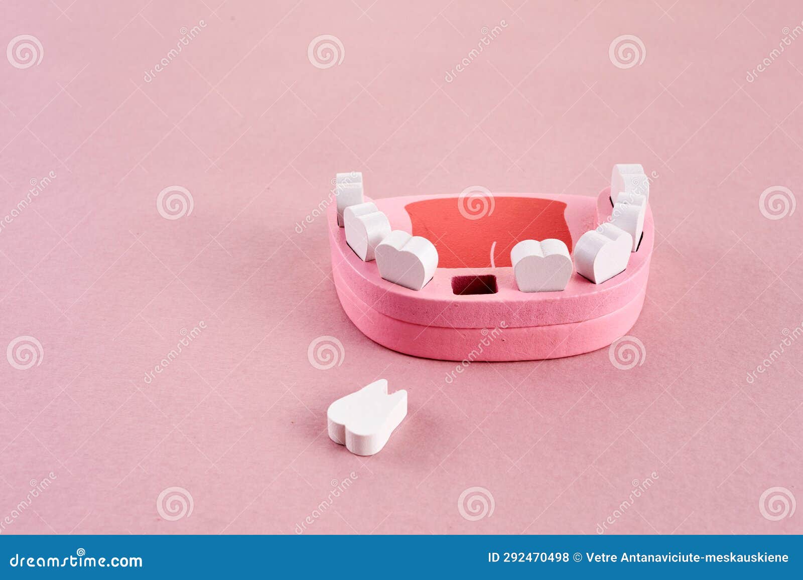 Teeth Loss Concept. Wooden Jaw Model with Missing or Extracted Tooth ...