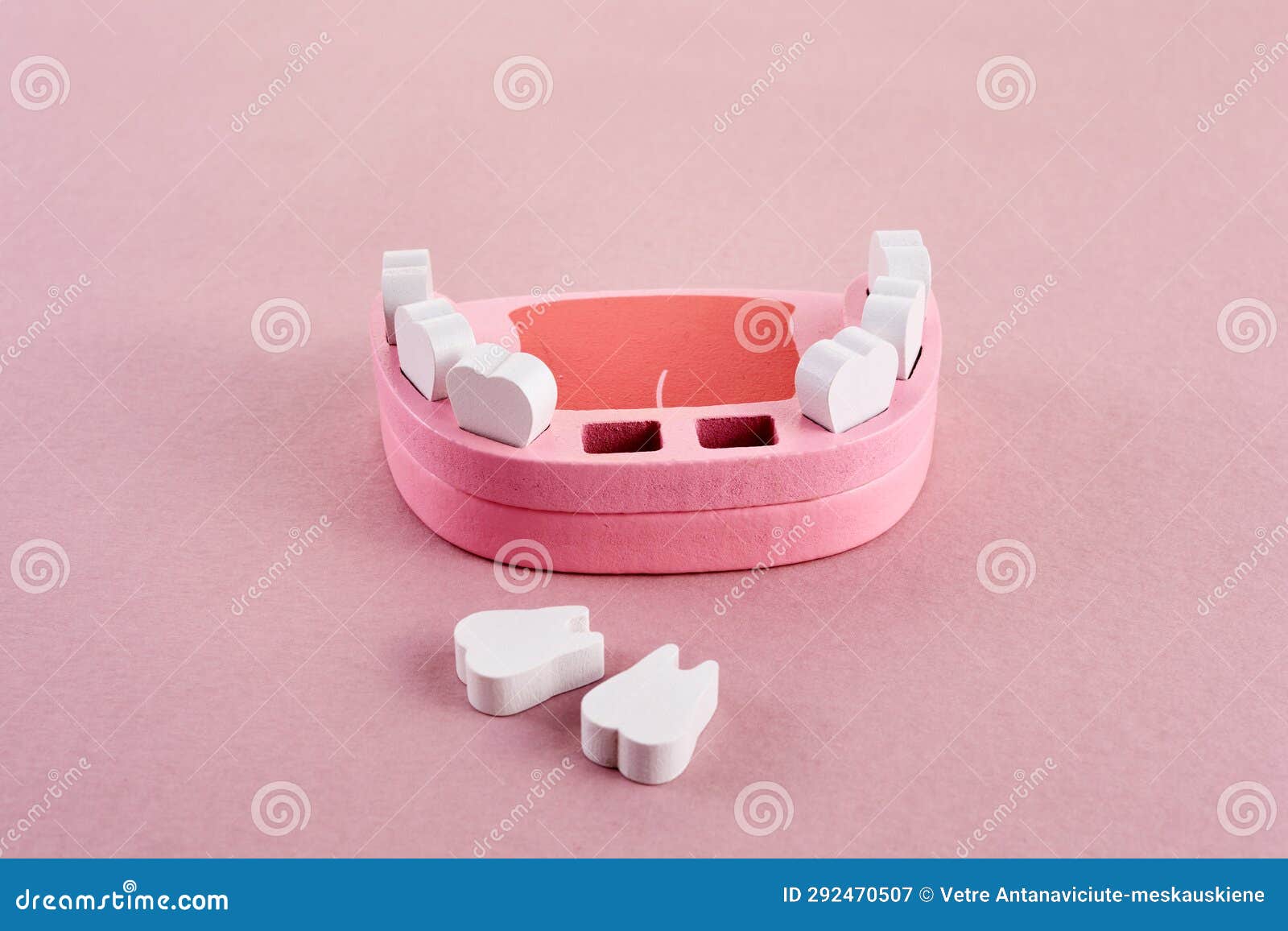 Teeth Loss Concept. Wooden Jaw Model with Missing or Extracted Tooth ...