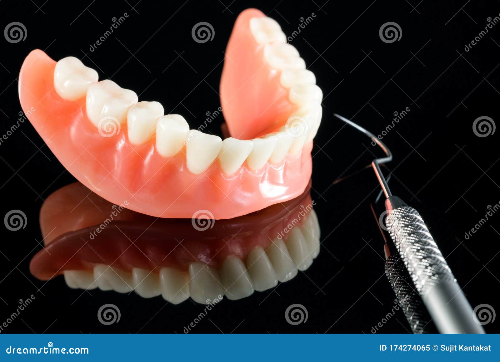 Teeth Model Showing an Implant Crown Bridge Model. Stock Image - Image ...
