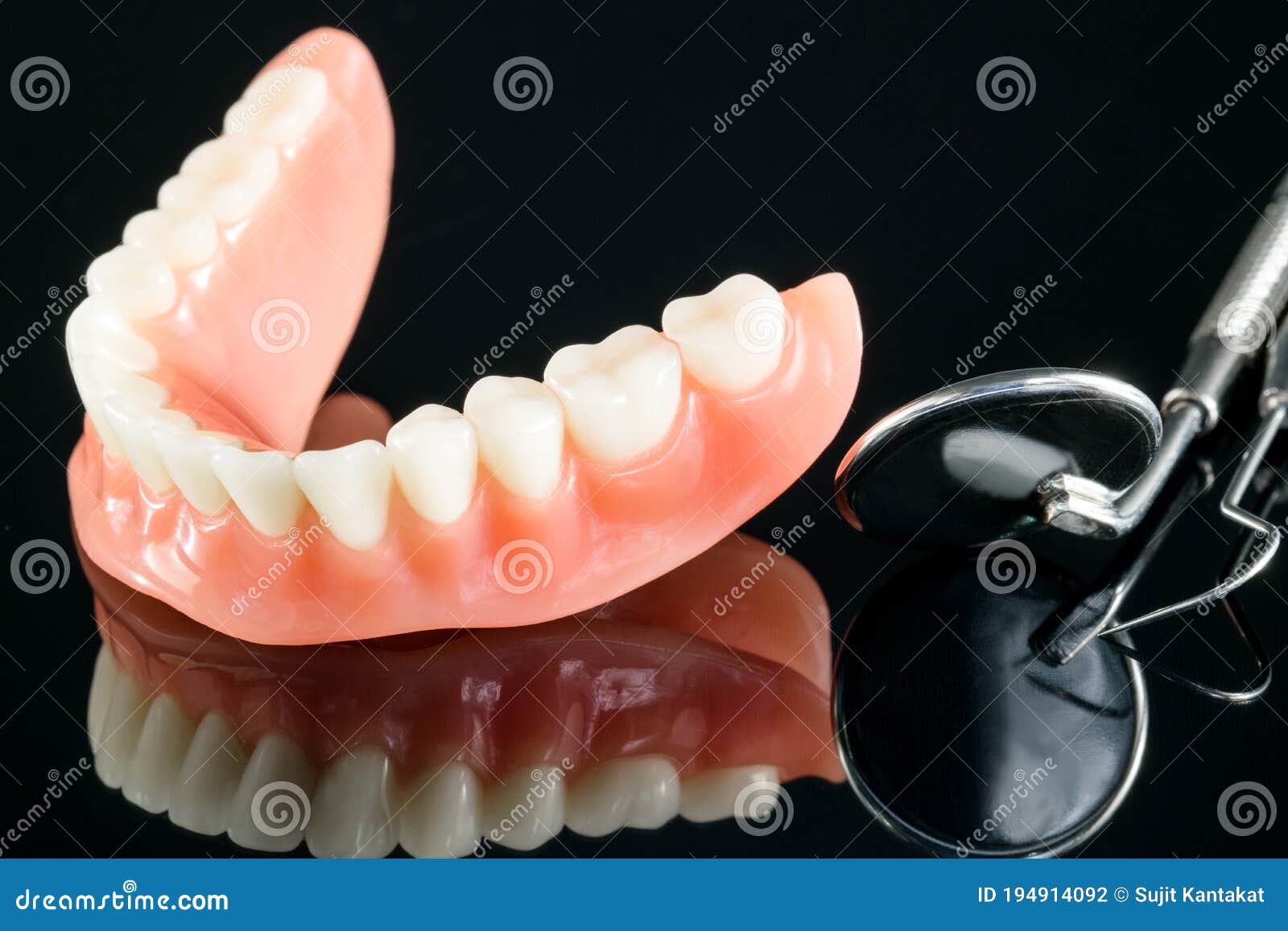 Teeth Model Showing an Implant Crown Bridge Model. Stock Photo - Image ...