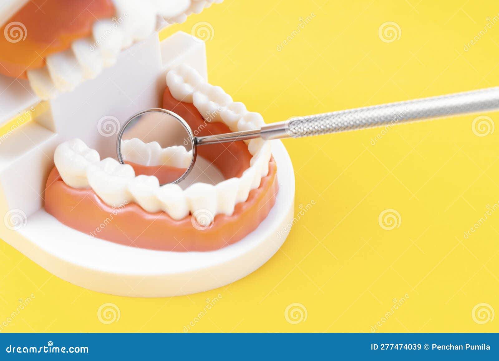 The Teeth Model Showing an Implant Dental Demonstration Teeth Study ...