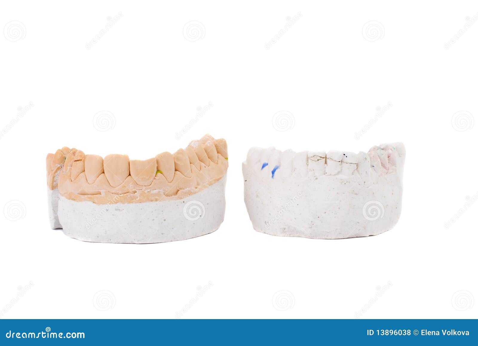 Teeth Plaster Cast. Close Up on White Background Stock Photo - Image of ...