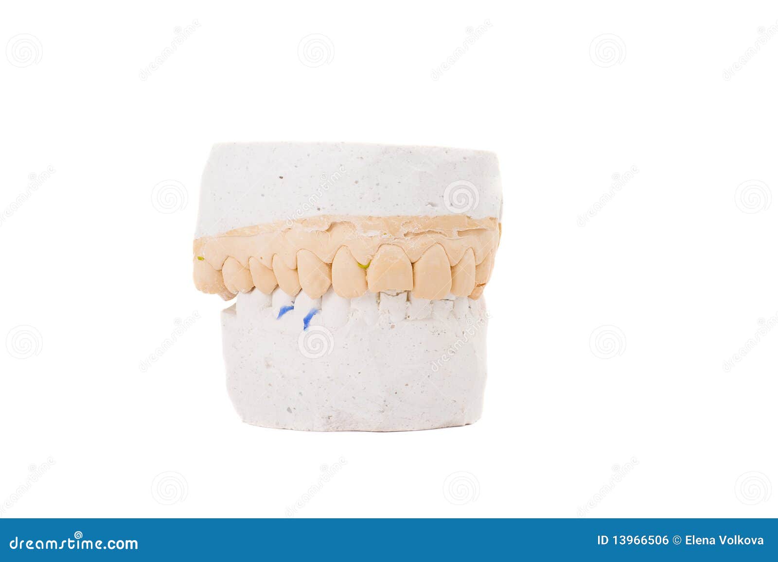Teeth Plaster Cast. Close Up On White Background Stock Photo - Image of ...