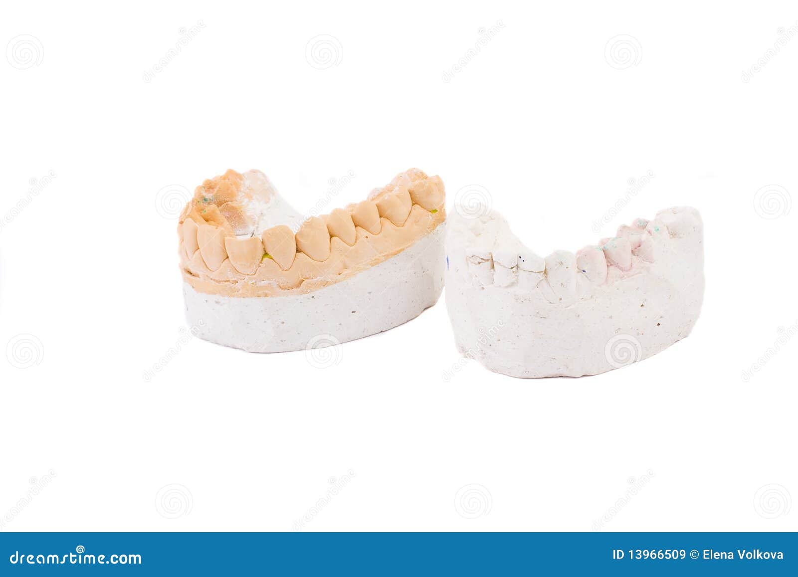 Teeth Plaster Cast. Close Up on White Background Stock Image - Image of ...