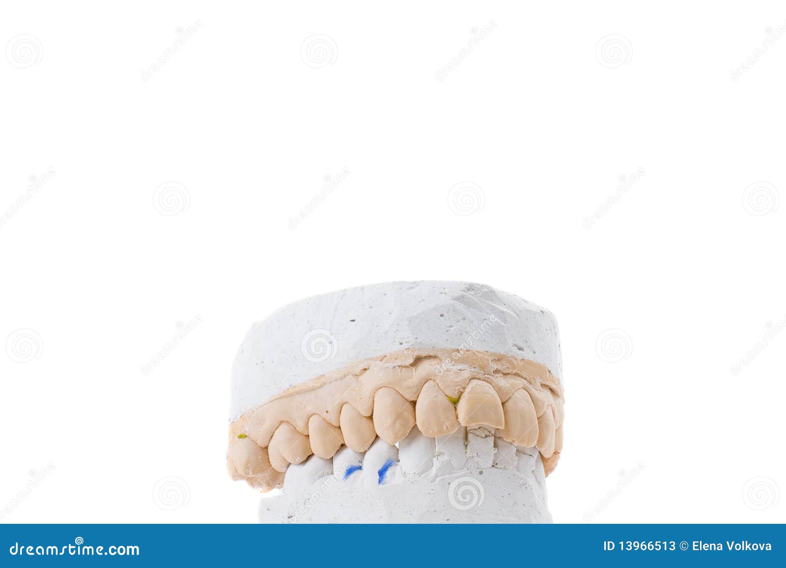 Teeth Plaster Cast. Close Up on White Background Stock Image - Image of ...