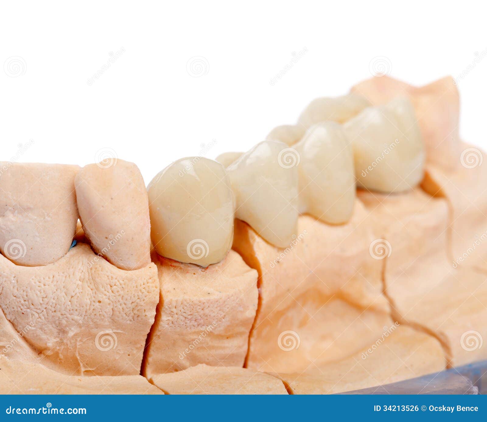 Teeth rehabilitation stock photo. Image of dentistry - 34213526