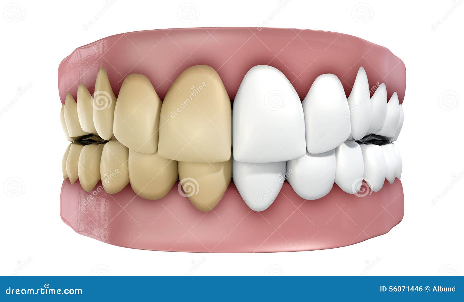 Teeth Set Isolated stock illustration. Illustration of stomatology ...
