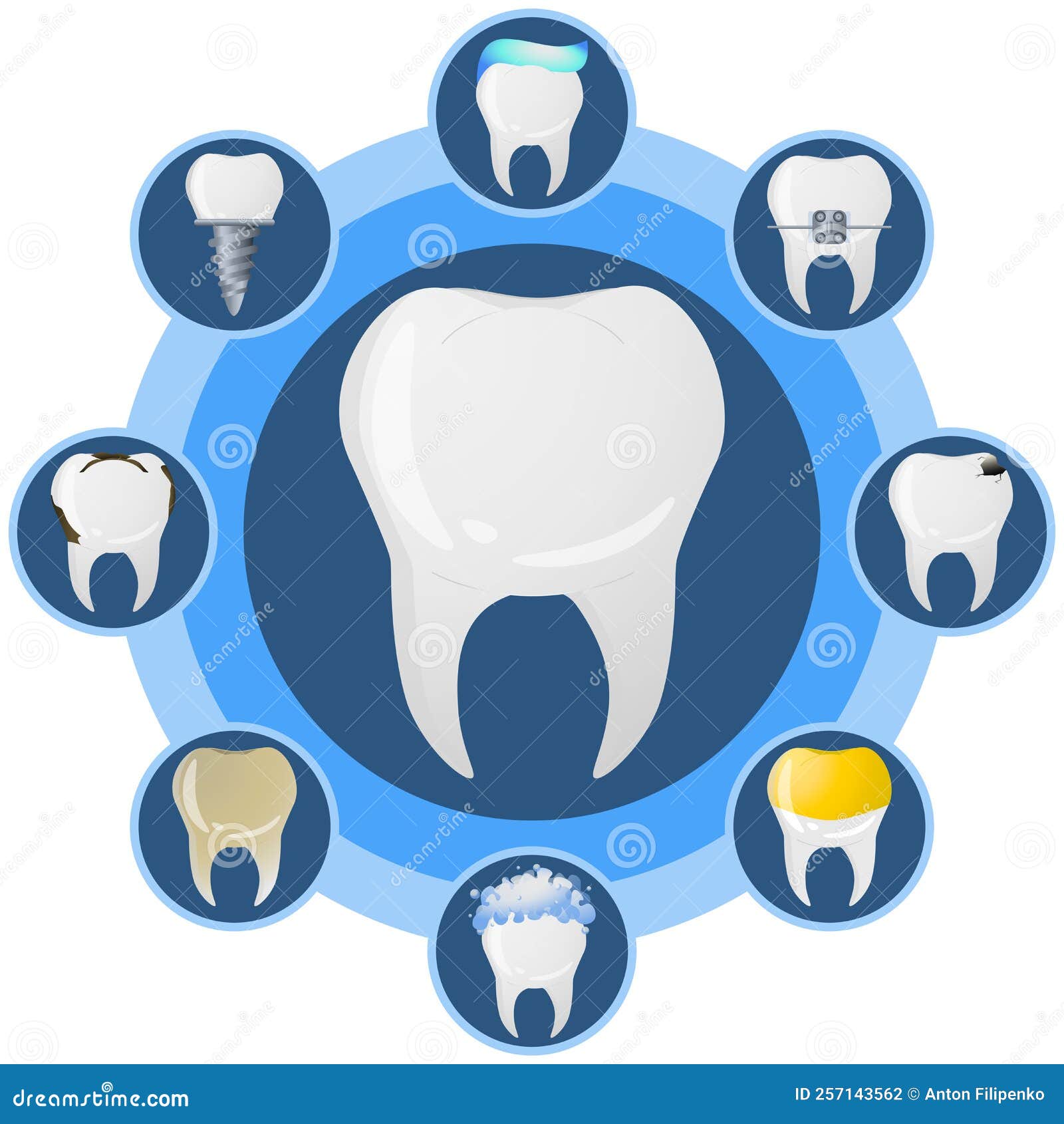 Teeth Set in Realistic Style. Dental Cleaning of Decay Stock ... Teeth Set in Realistic Style. Dental Cleaning of Decay Stock ...
