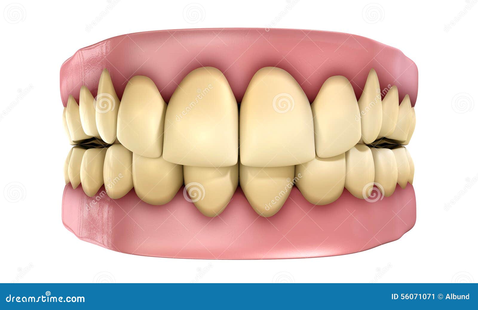 Yellow Teeth Clipart