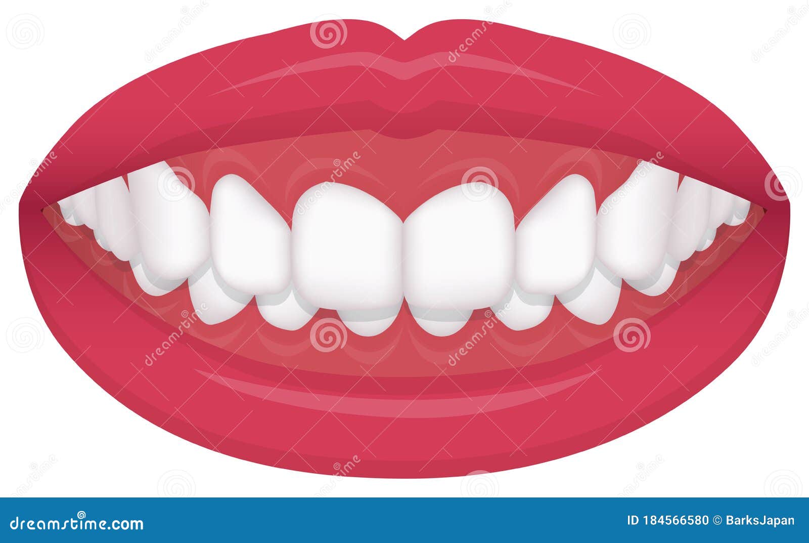 Teeth Trouble Bite Type / Crooked Teeth Vector Illustration /Deep Bite ...