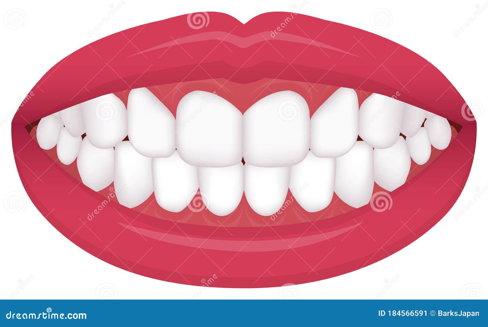 Teeth Trouble Bite Type / Crooked Teeth Vector Illustration / Even ...
