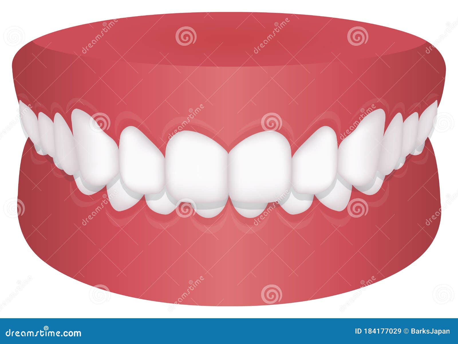 Teeth Trouble Bite Type Vector Illustration /Deep Bite Stock Vector ...