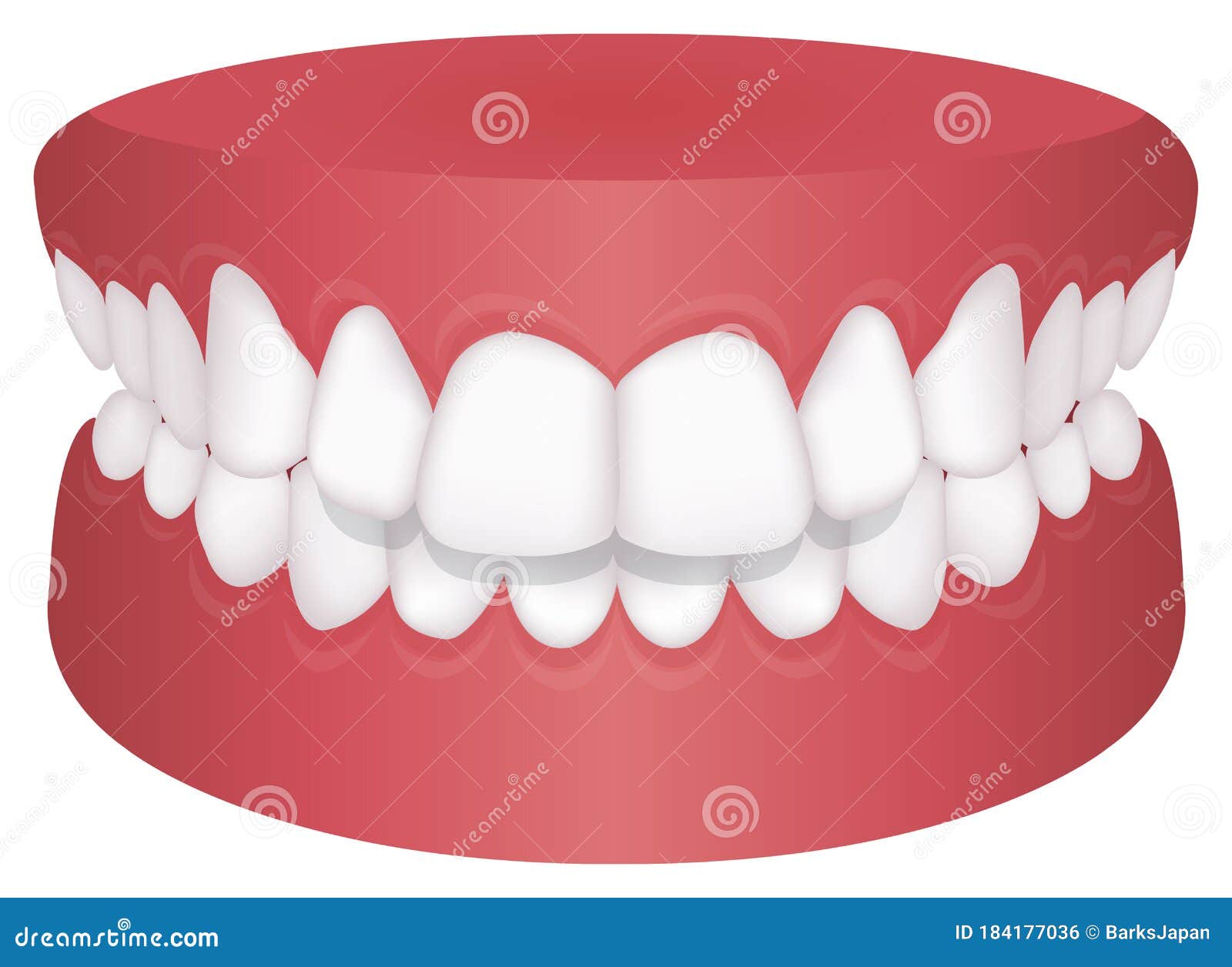 Teeth Trouble Bite Type Vector Illustration //Overbite Back Teeth Stock ...